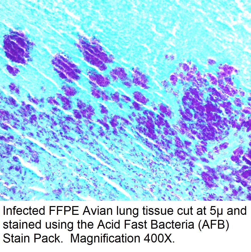 Acid Fast Bacteria (AFB) Stain Pack, 125ml