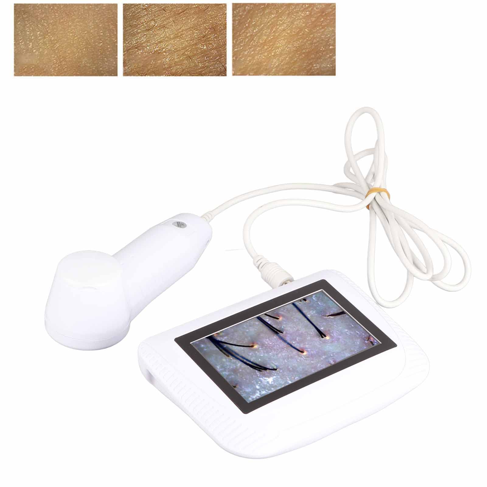 Skin Diagnosis Hair Analyzer, 5 Inch LCD Screen Digital Skin Detector Tester Hair Skin Analyzer Machine Skin Pigment Tester, HD Skin and Hair Detection Hair Follicle Detector (US)