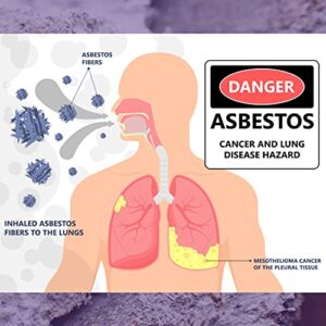 PRO-LAB Asbestos Test Kit - You Collect 2 Samples, We Analyze Them. Emailed Results Within 1 Week (5 Business Days) Includes Return Mailer and Expert Consultation. Lab Fee Included