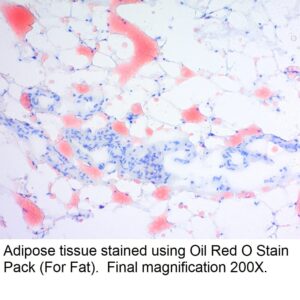 Oil Red O Stain Pack (for Fat), 125ml