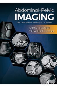 abdominal-pelvic imaging: 200 cases (common diseases): us, ct and mri