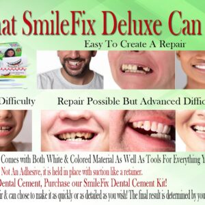 SmileFix Deluxe Dental Repair Kit - Color Matching Compound - Includes Tools - Missing Or Damaged Teeth - Fix Gaps, Broken Teeth - Durable Tooth Repair - Fast & Easy Process