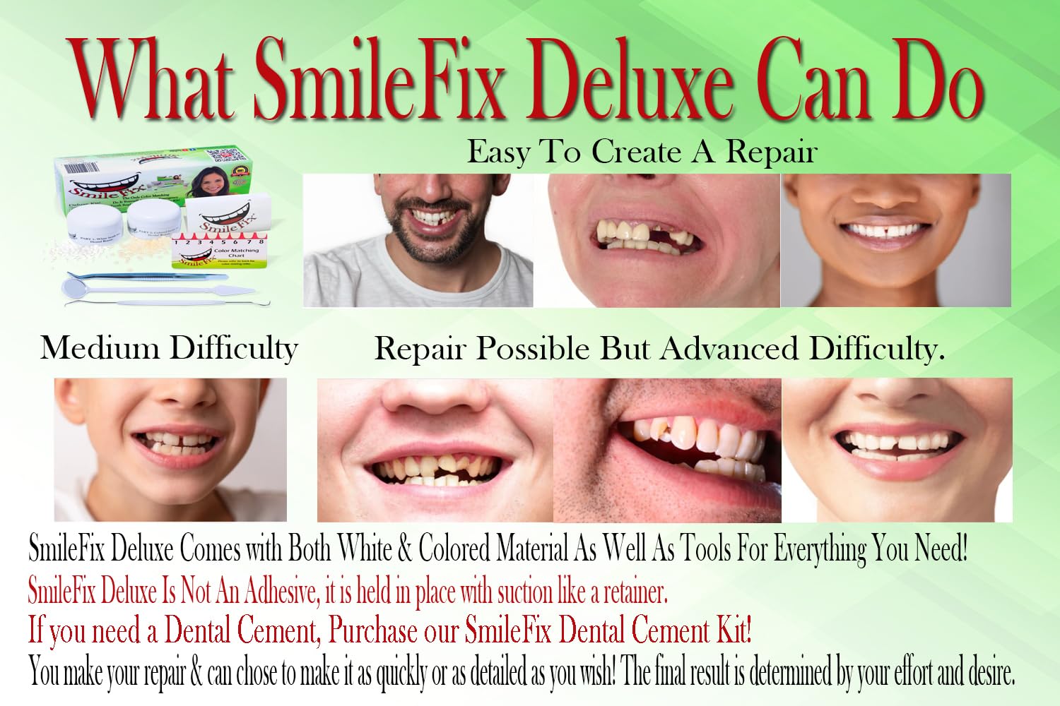 SmileFix Deluxe Dental Repair Kit - Color Matching Compound - Includes Tools - Missing Or Damaged Teeth - Fix Gaps, Broken Teeth - Durable Tooth Repair - Fast & Easy Process