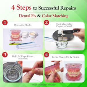 SmileFix Deluxe Dental Repair Kit - Color Matching Compound - Includes Tools - Missing Or Damaged Teeth - Fix Gaps, Broken Teeth - Durable Tooth Repair - Fast & Easy Process