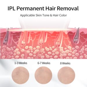 COSBEAUTY At-Home IPL Hair Removal for Women and Men, Painless Laser Permanent Hair Removal Device, FDA Cleared, At Home Use for Armpits Back Legs Arms Face Bikini Line,3 Treatments Heads