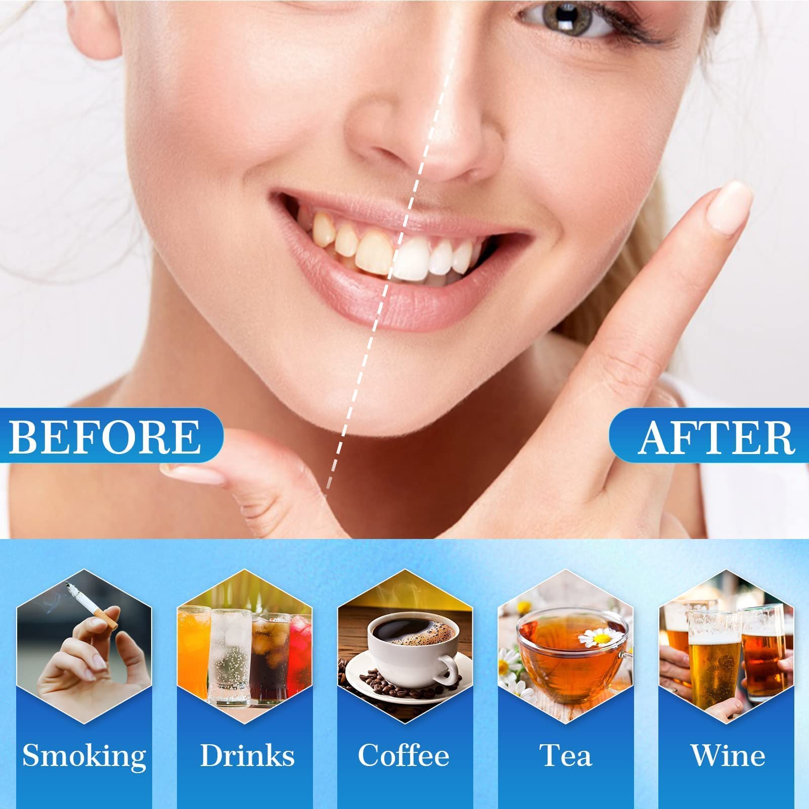 Teeth Whitening Kit with Blue Light, Professional Teeth Whitener with 12 Whitening Gel, 3 Soothing Gel, Mouth Tray- Remove Stains from Coffee,Smoking,Wines- 15 Minutes Effective Home Tooth Whitening