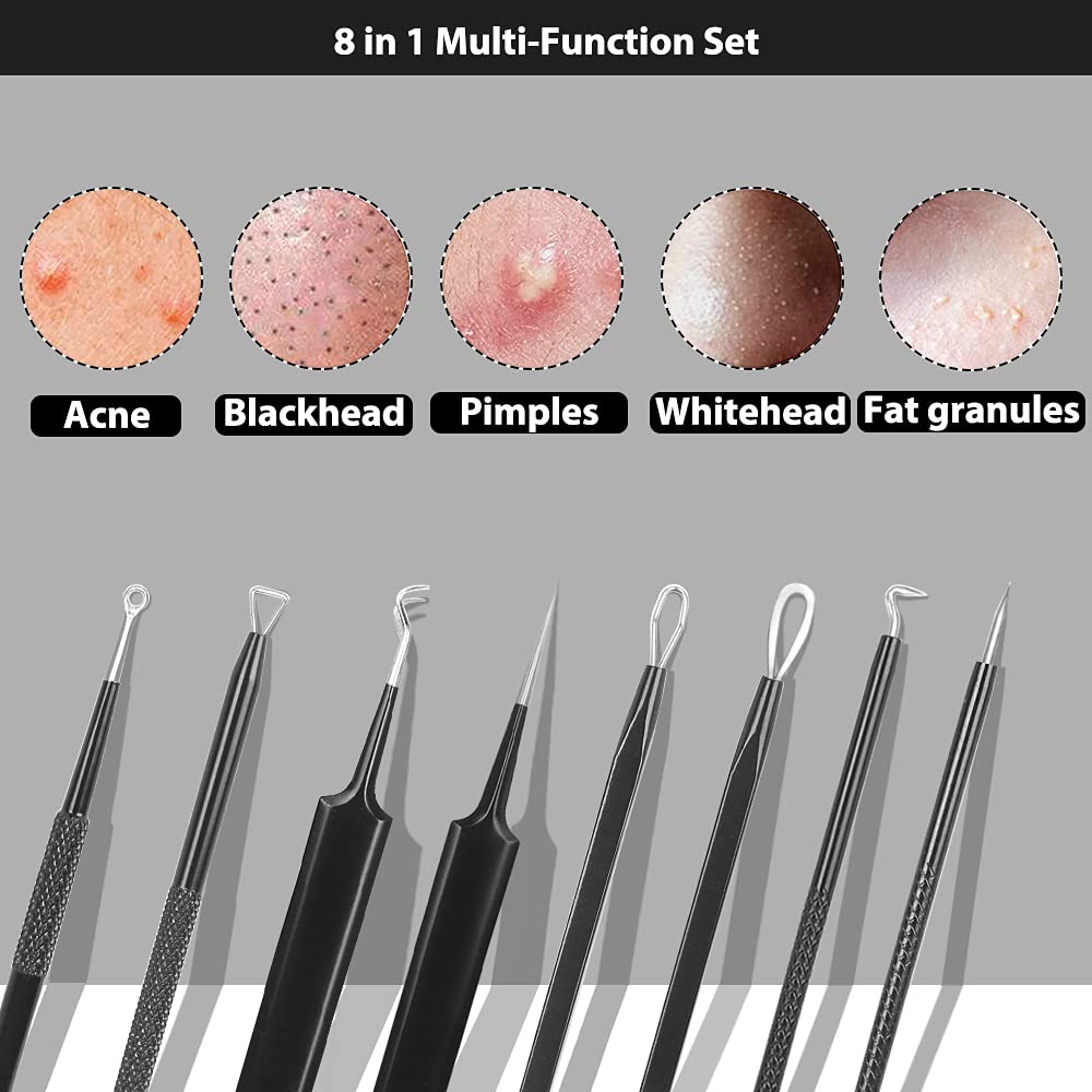 Glamne Blackhead Remover Pimple Popper Kit Acne Comedone Extractor Blemish Extraction Popping Tools (Black)