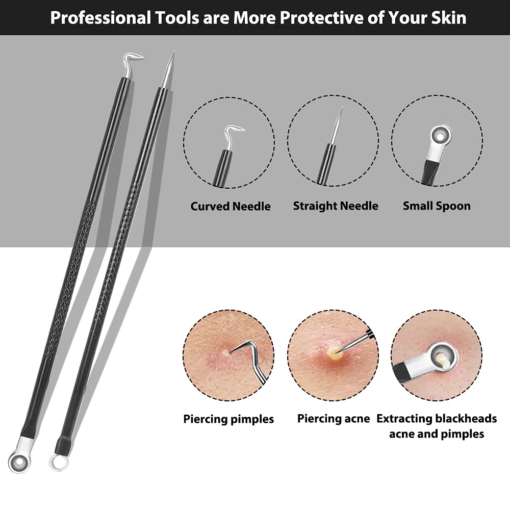 Glamne Blackhead Remover Pimple Popper Kit Acne Comedone Extractor Blemish Extraction Popping Tools (Black)