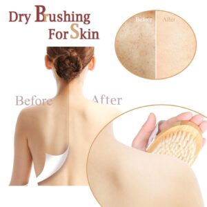 Ftzotof Dry Brush, Dry Brushing Body Brush with Natural Bristles, Exfoliating Brush Body Scrub for Dry Skin, Cellulite Treatment, Lymphatic Drainage and Blood Circulation Improvement, Medium Strength