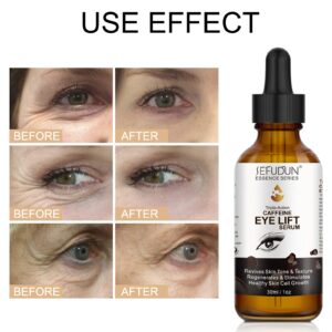 PEPHUCA Dark Circles Under Eye Treatment for Women Caffeine Serum Circles, Puffiness, Bags, Anti Aging Reduces Wrinkles and Fine Line, 100% Pure Coffee Oil - 1 oz / 30 ml, 1 Fl Oz (Pack of 1)