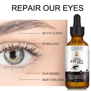 PEPHUCA Dark Circles Under Eye Treatment for Women Caffeine Serum Circles, Puffiness, Bags, Anti Aging Reduces Wrinkles and Fine Line, 100% Pure Coffee Oil - 1 oz / 30 ml, 1 Fl Oz (Pack of 1)