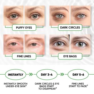 Under Eye Mask for Puffy Eyes, Dark Circles, Eye Bags, Puffiness, Wrinkles with Collagen - Hydrating Under Eye Patches - Green Tea Skincare - Anti-Aging Eye Patch Treatment Masks - 60 Under Eye Pads