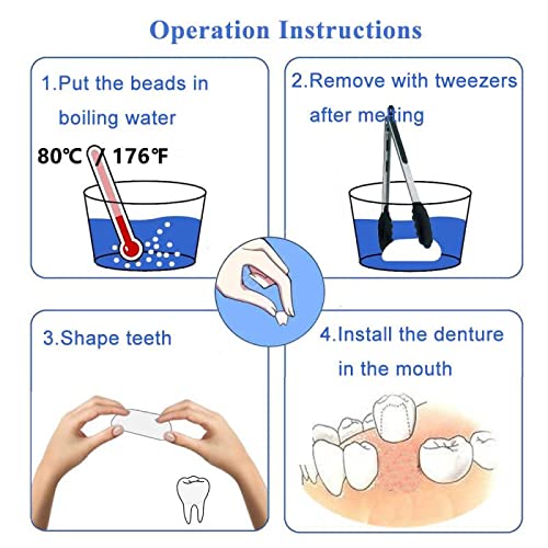 Tooth Repair Kit, Moldable False Teeth Thermal Fitting Beads,Temporary Filling Broken Teeth Gap for Snap On Instant and Confident Smile, Denture Adhesive