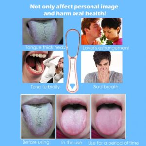 Xiahium Tongue Scraper, Fresh Breath Tongue Cleaner Reusable Fight Bad Breath Healthy Oral Care for Adults Kids - 100% BPA Free