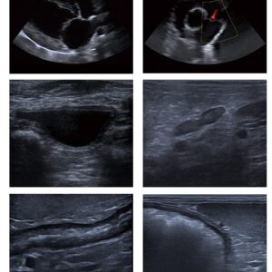 CONTEC Veterinary Ultrasound Scanner Color Doppler for Pregnancy in Animals Dogs Goats mare Horses Cattles with Tow probes convex and rectal linear probe