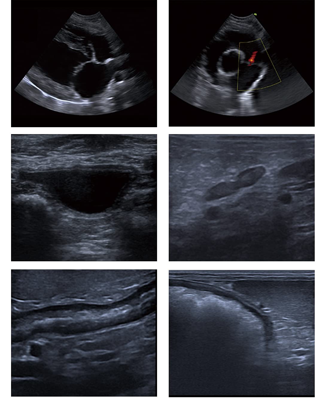 CONTEC Veterinary Ultrasound Scanner Color Doppler for Pregnancy in Animals Dogs Goats mare Horses Cattles with Tow probes convex and rectal linear probe