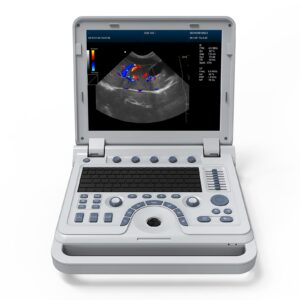 CONTEC Veterinary Ultrasound Scanner Color Doppler for Pregnancy in Animals Dogs Goats mare Horses Cattles with Tow probes convex and rectal linear probe