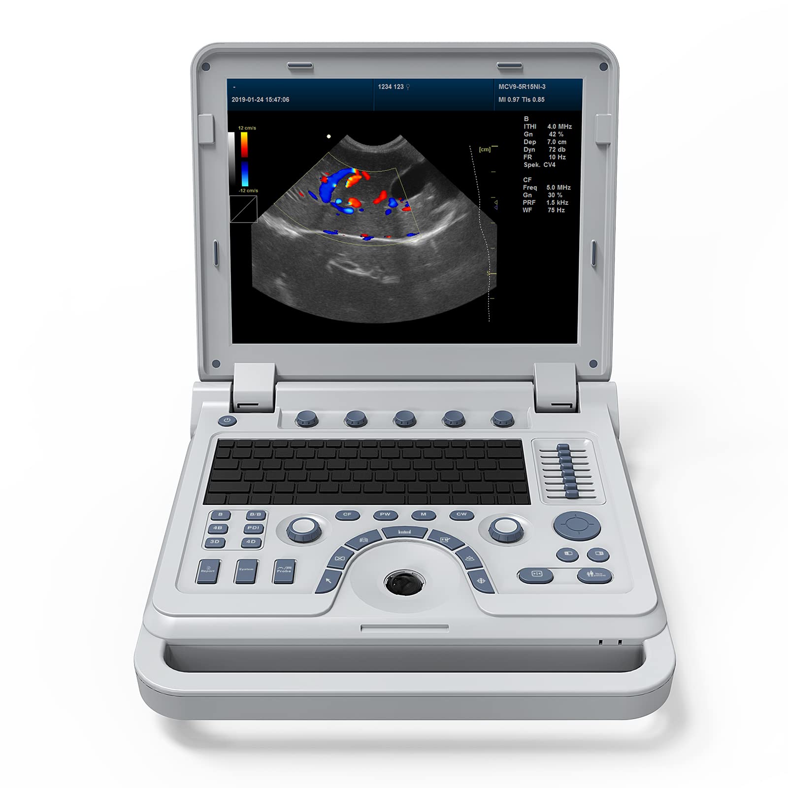 CONTEC Veterinary Ultrasound Scanner Color Doppler for Pregnancy in Animals Dogs Goats mare Horses Cattles with Tow probes convex and rectal linear probe