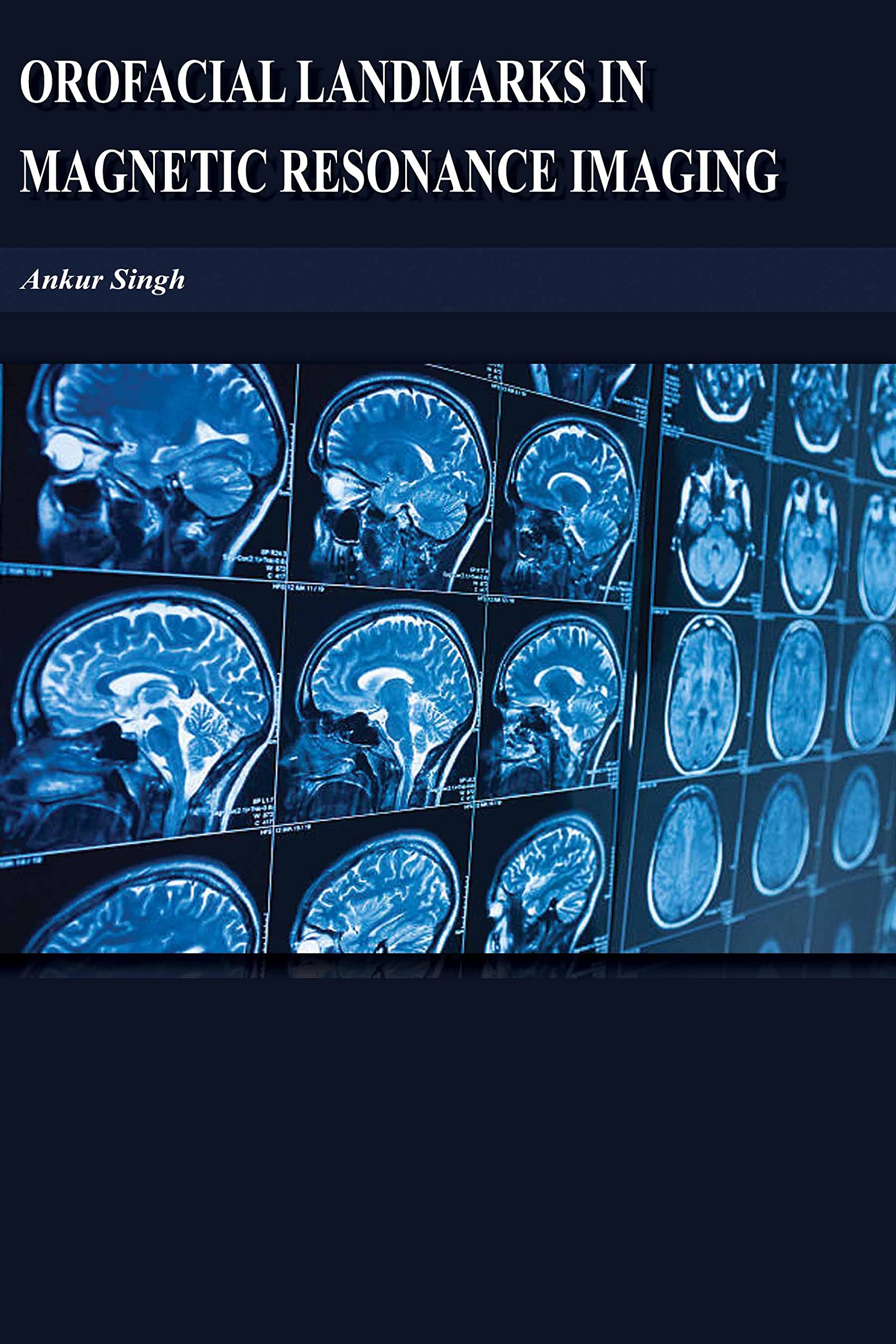 Orofacial Landmarks in Magnetic Resonance Imaging