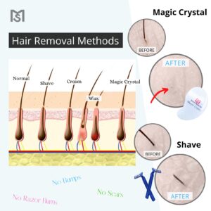 Magic Crystal Painless Hair Remover for Men and Women (New Technology) Fast & Easy - Soft Smooth Silky Skin, Clear Glitter