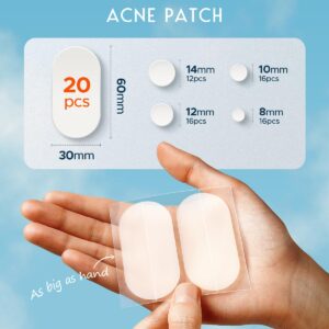 LitBear Large Acne Pimple Patches, 5 Sizes 80 Patches for Large Breakouts, Acne Patches for Face, Chin or Body, Acne Spot Patch with Tea Tree & Calendula Oil, Hydrocolloid Bandages for Acne Skin