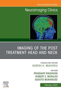 imaging of the post treatment head and neck, an issue of neuroimaging clinics of north america, e-book (clinics collections)