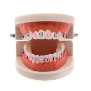 angzhili 1 piece dental demonstration orthodontic model with metal wires and bracket (ceramic bracket)