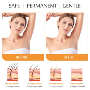 TECHCIFY Laser Hair Removal | Permanent Painless Hair Removal for Women | IPL Hair Removal with Five Energy Levels and 999,999 Flashes | Epilation for Women and Men at Home