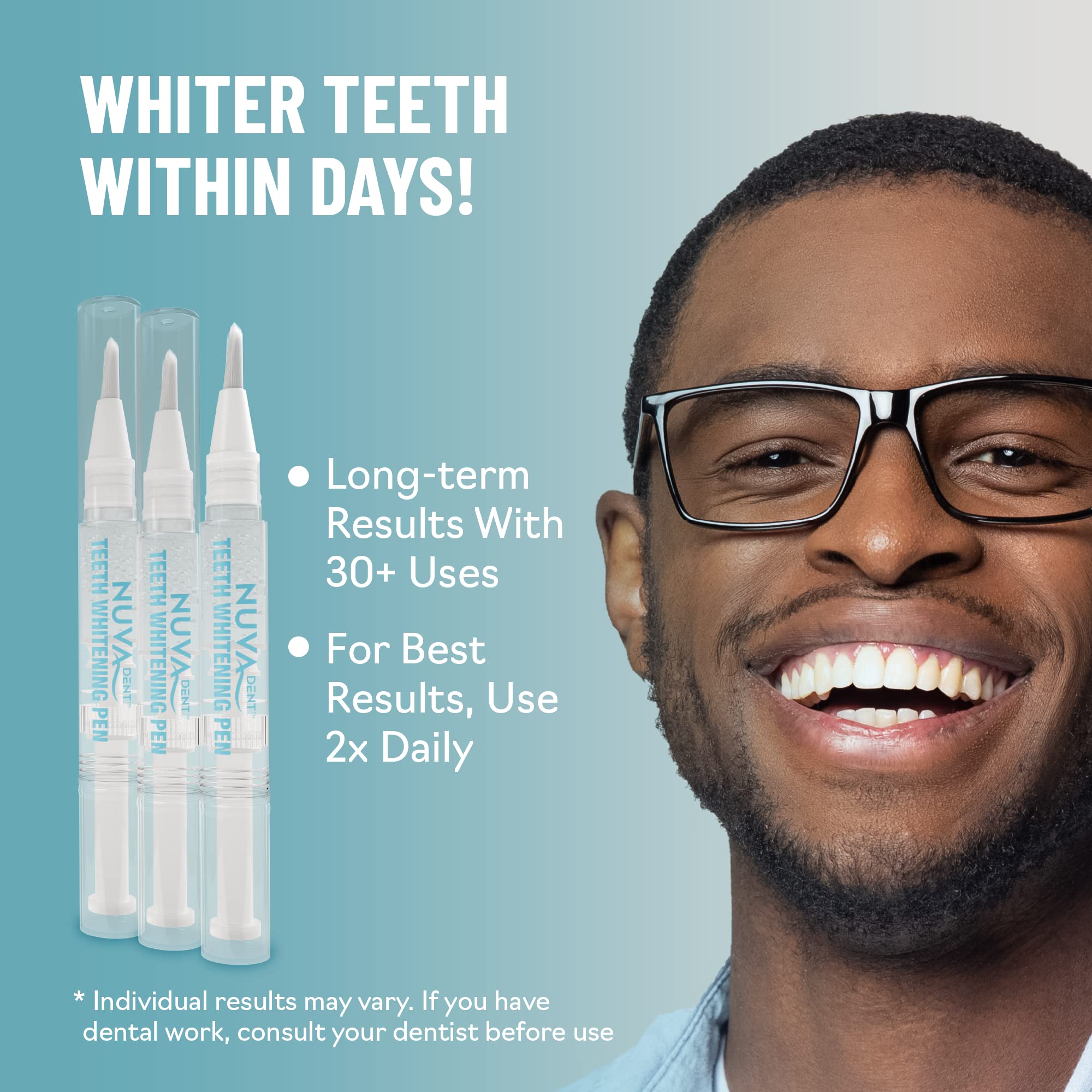 Nuva Dent Sensitive Teeth Whitening Pens - Tooth Whitening Pens Made in USA - 35% Carbamide Peroxide Whitening Gel Teeth Stain Remover - Teeth Whitener, Blanqueador de Dientes Profesional (3 Pcs)