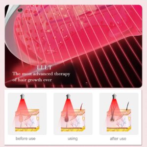 iHelmet Laser Hair Growth System, Hair Regrowth Helmet & Laser Cap (FDA Cleared), Hair Loss Treatment for Men and Women, Low Level Laser Therapy for Hair Growth, Anti-Thining Treatment Pink, 36 Air