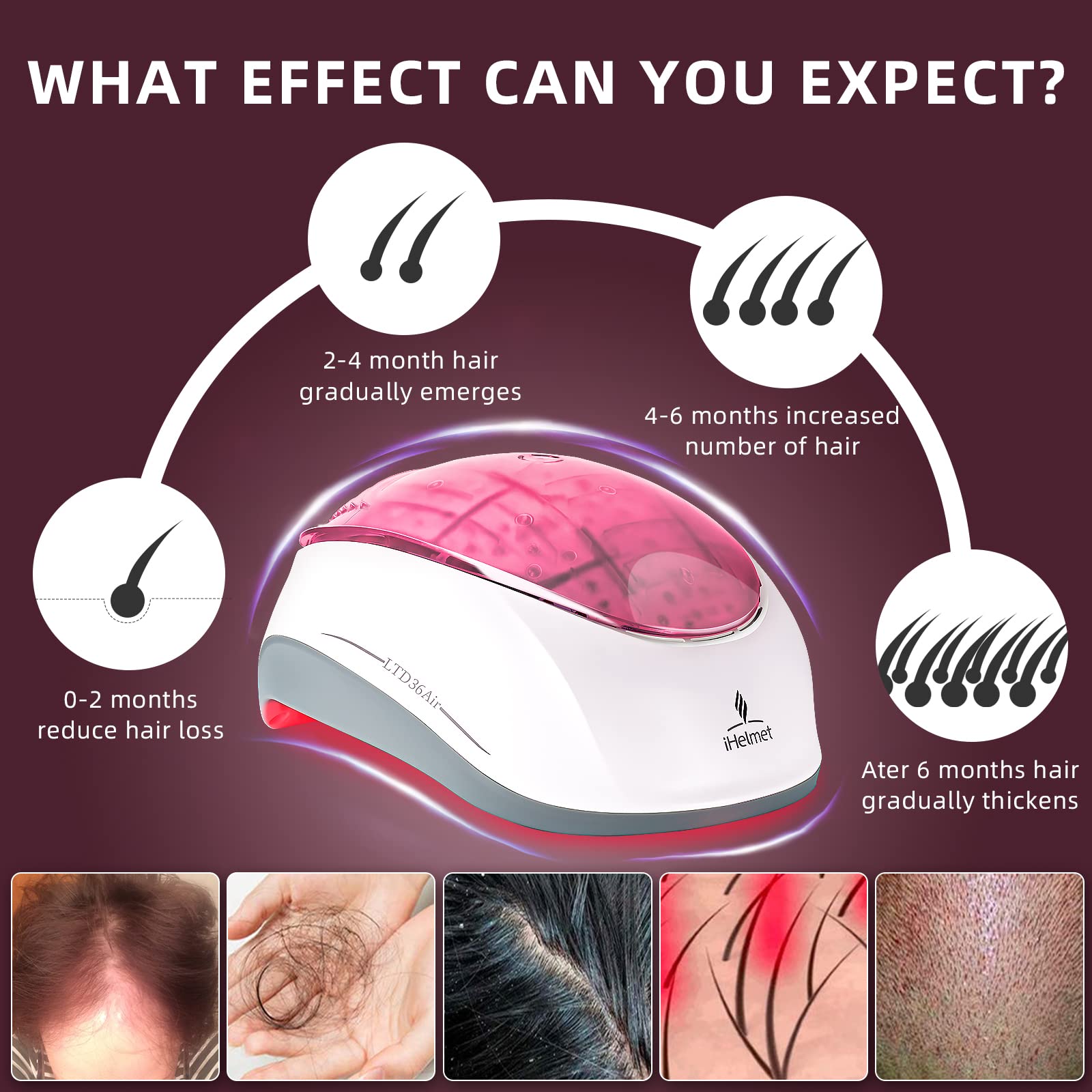 iHelmet Laser Hair Growth System, Hair Regrowth Helmet & Laser Cap (FDA Cleared), Hair Loss Treatment for Men and Women, Low Level Laser Therapy for Hair Growth, Anti-Thining Treatment Pink, 36 Air