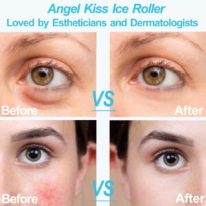 Angel Kiss Ice Roller for Face Eye, Women Gift Idea, Cold Therapy Massager for Reduce Puffiness, Redness, Dark Circles, Tightening Firming, Reduce Wrinkles, Migraine Pain Relief, w/Premium Carry Case