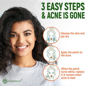 Acne Patches - Natural Hydrocolloid Bandages for Acne Spot Treatment - Cystic Acne Cover Patches with Salicylic, Hyaluronic Acids and Tea Tree Oil - Pimple Patches for Face - 120 Patches