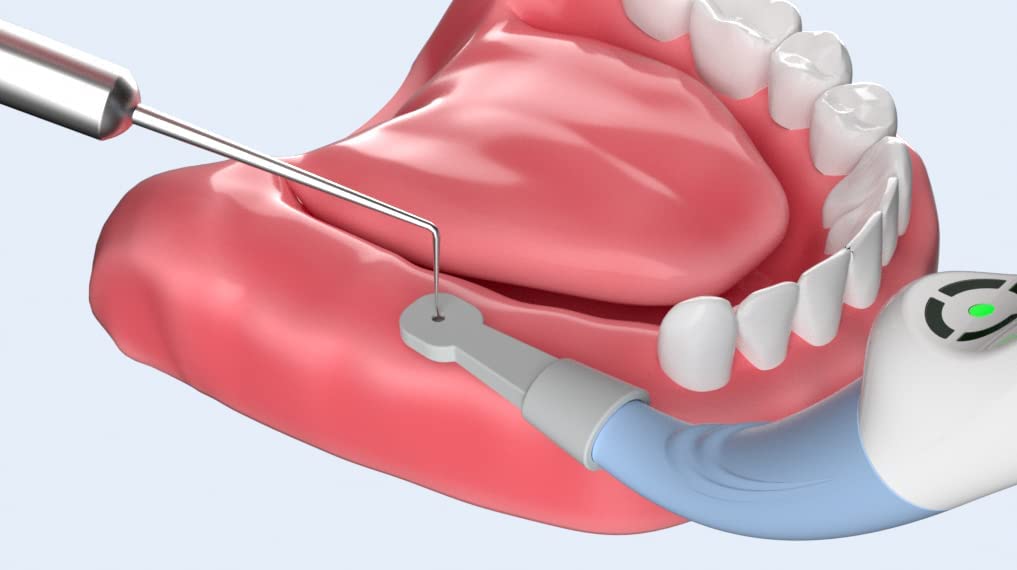 Dental Implant Detector Three-Dimensional Implant Locator Easydo-Detector with 3PCS Sensor Heads