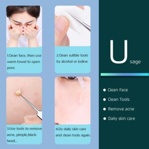 Best Acne Removal, Blackhead Remover, Pimple Comedone Extractor, Blemish Whitehead Removing, Popping Zit Tool, Popper Kit, for Nose Face