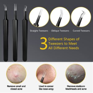 19 Pcs Blackhead Remover Pimple Popper Tool Kit,Professional Blackhead Extractor Tool for Nose Face, Stainless Comedone Extractor, Blemish Whitehead Popping Tool with Portable Metal Case (Black)