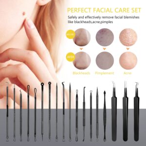 19 Pcs Blackhead Remover Pimple Popper Tool Kit,Professional Blackhead Extractor Tool for Nose Face, Stainless Comedone Extractor, Blemish Whitehead Popping Tool with Portable Metal Case (Black)