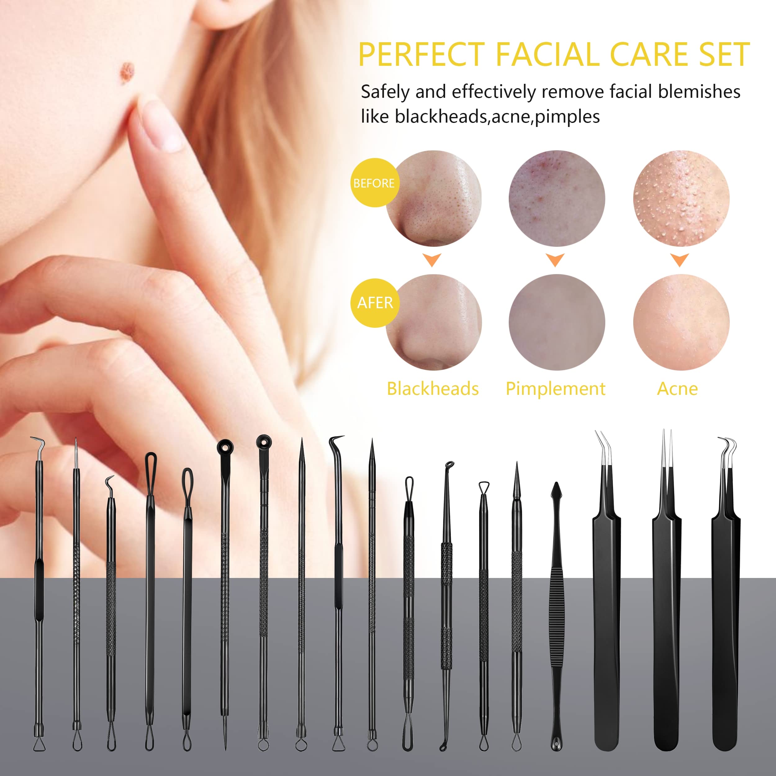 19 Pcs Blackhead Remover Pimple Popper Tool Kit,Professional Blackhead Extractor Tool for Nose Face, Stainless Comedone Extractor, Blemish Whitehead Popping Tool with Portable Metal Case (Black)