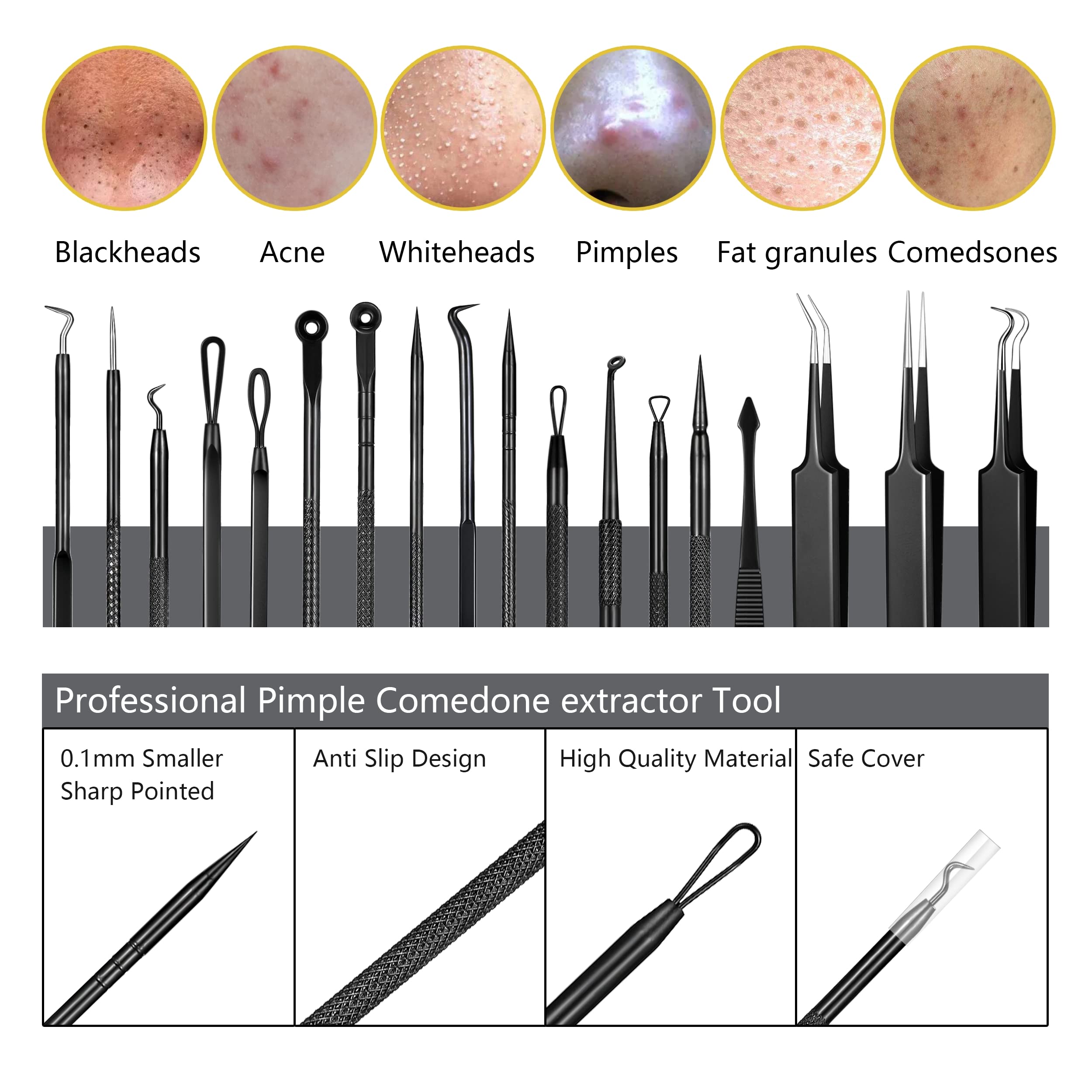 19 Pcs Blackhead Remover Pimple Popper Tool Kit,Professional Blackhead Extractor Tool for Nose Face, Stainless Comedone Extractor, Blemish Whitehead Popping Tool with Portable Metal Case (Black)