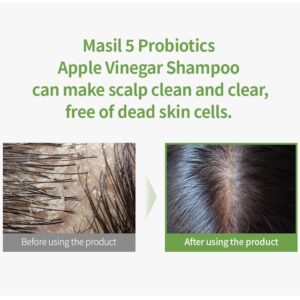 Masil Probiotics Apple Cider Vinegar Shampoo - 5.1floz, Reduces Itchy Scalp, Dandruff and Frizz, Sulfate-Free, Restores Shine with Vitamin E and Optimal pH