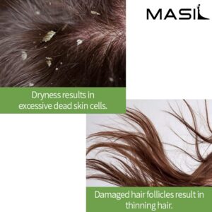 Masil Probiotics Apple Cider Vinegar Shampoo - 5.1floz, Reduces Itchy Scalp, Dandruff and Frizz, Sulfate-Free, Restores Shine with Vitamin E and Optimal pH