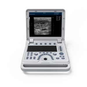 CONTEC CMS600P2PLUS Vet/Veterinary/Animal Portable B-Ultrasound Scanner for Horse, Equine,Goat,Cow