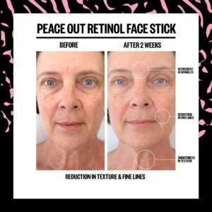 Peace Out Skincare Retinol Face Stick. Reduce Fine Lines, Wrinkles and Uneven Texture with 3% Encapsulated Retinol (.28 oz)