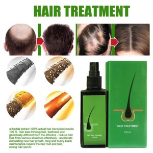 Hair Growth Serum for Men and Women - Natural Nourishing Scalp Spray for Hair Lotion, Hair Root, Thinning Hair, and Hair Loss (120ml)