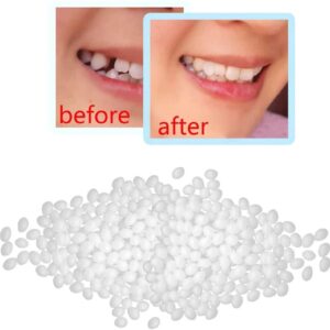 SINGOVE Temporary Tooth Repair kit for Filling The Missing Broken Tooth and Gaps-Moldable Fake Teeth and Thermal Beads Replacement Kit,Artfifical Teeth, Make Smile Confidently (White, One Size)