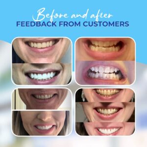 LUELLI Teeth Whitening Strips - White Strips Teeth Whitening Kit - Whiter Teeth in 7 Days Up to 10 Shades Whiter - 14 Treatments 28 Strips