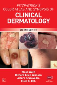 fitzpatrick's color atlas and synopsis of clinical dermatology, 8th ed