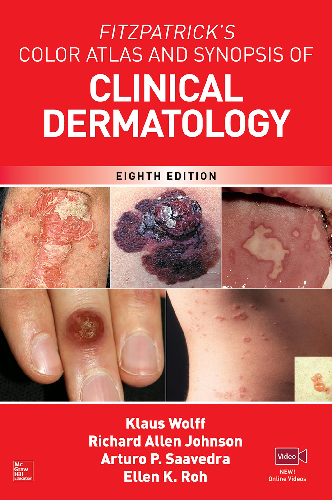 Fitzpatrick's Color Atlas AND SYNOPSIS OF CLINICAL DERMATOLOGY, 8th Ed