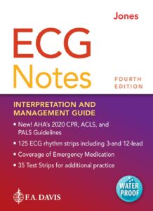 ecg notes interpretation and management guide