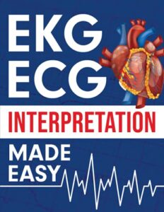 ekg | ecg interpretation made easy: an illustrated study guide for students to easily learn how to read & interpret ecg strips